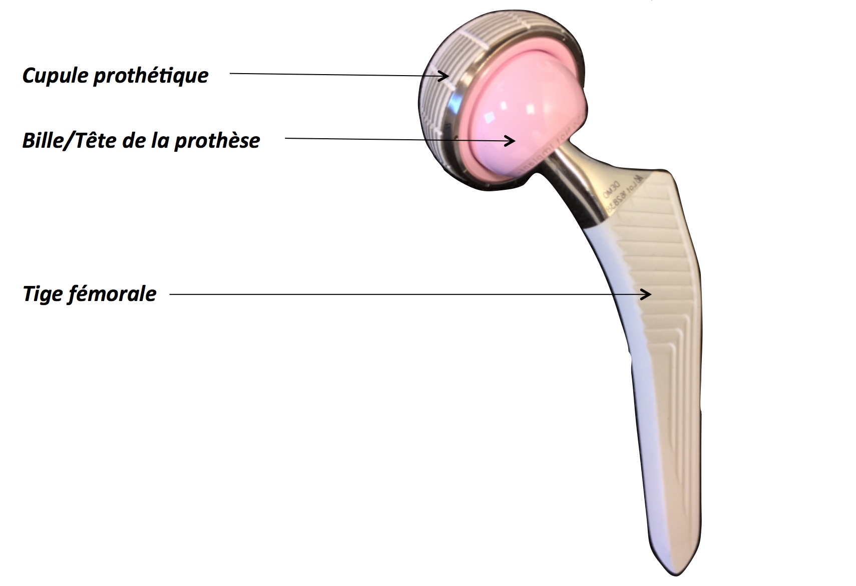 Prothèse totale de hanche - Clinique Ostéo Articulaire des Cèdres ...